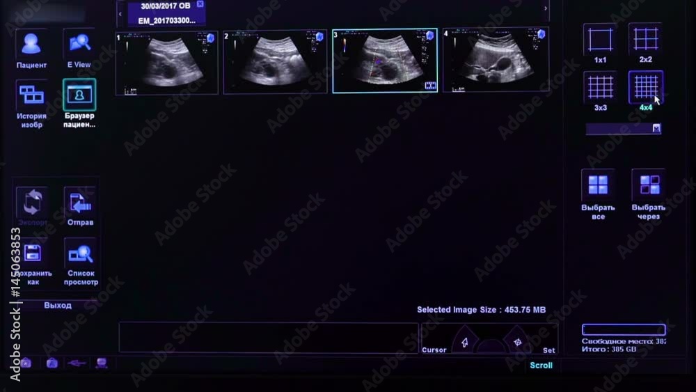 Display of electronic device for ultrasonography with the images of ...