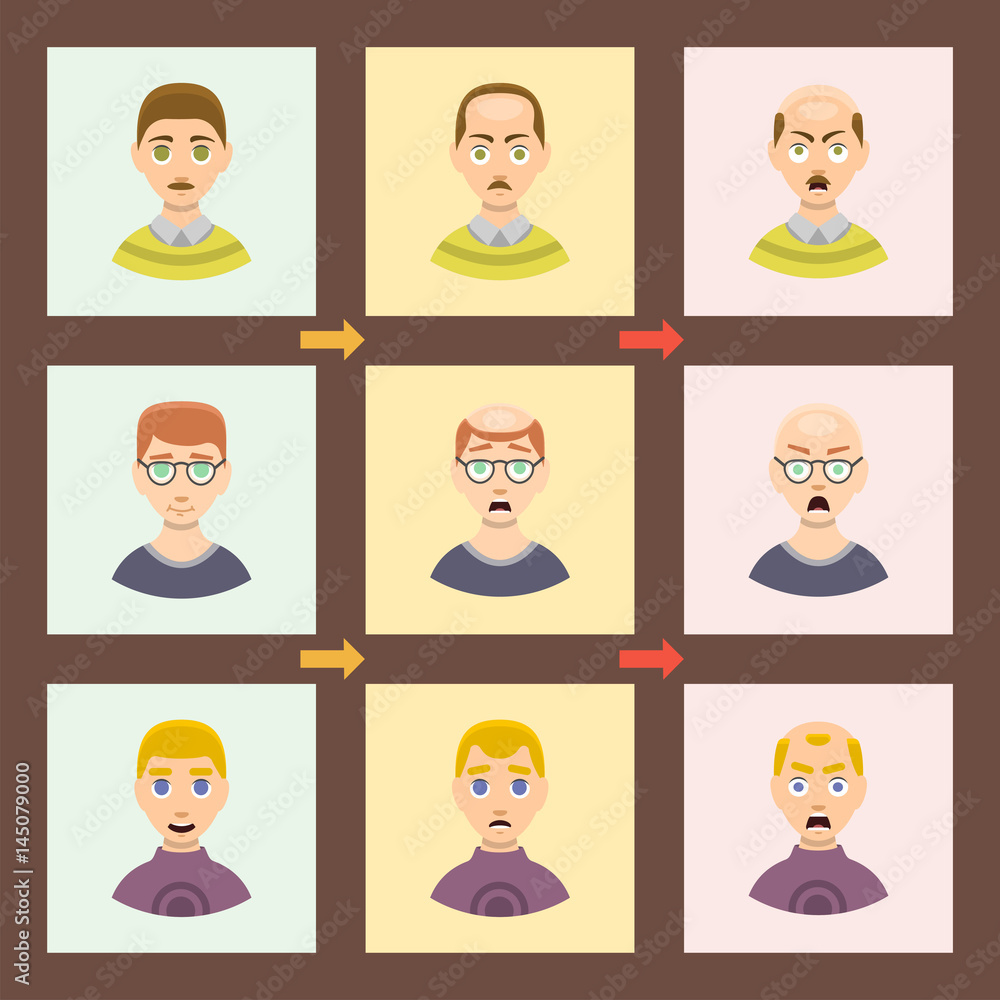 Information chart of hair loss stages types of baldness illustrated on ...