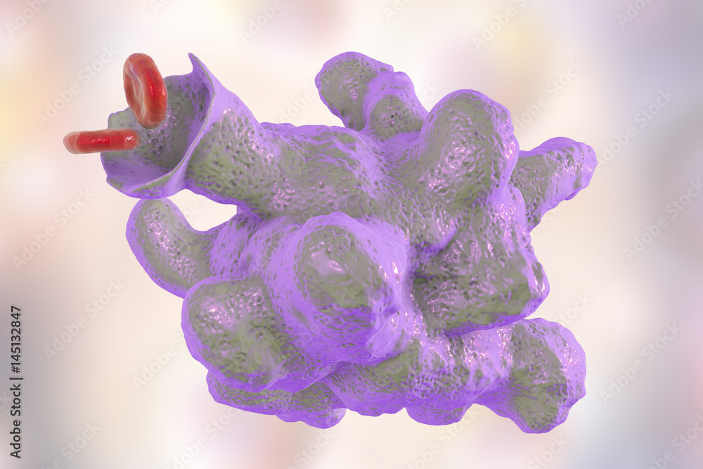 Entamoeba histolytica protozoan engulfing red blood cells. Parasite ...