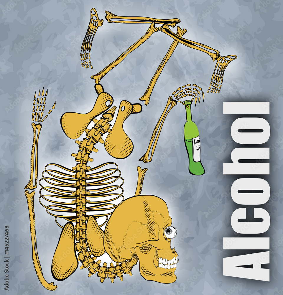 Concept on theme no alcohol. Broken skeleton with a bottle of al Stock ...