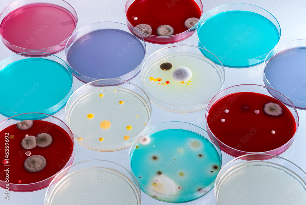 petri dishes in the workbench of lab / Growth plates in the laboratory ...
