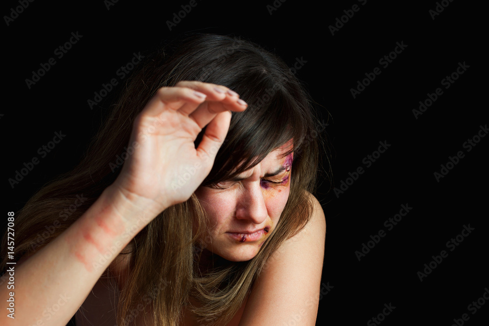 Beaten young woman with bruises on her face trying to protect herself ...