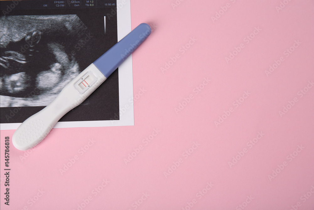 Ultrasound photo and pregnancy test on pink background Stock Photo ...