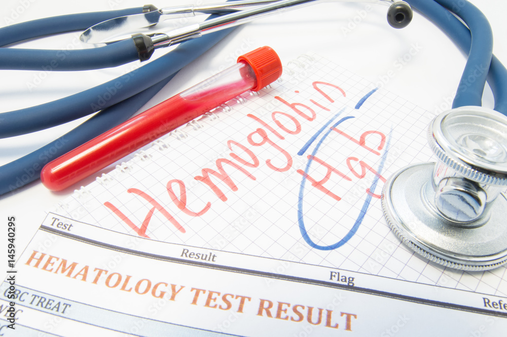 Foto de Laboratory test tube with blood, result of hematology test and ...