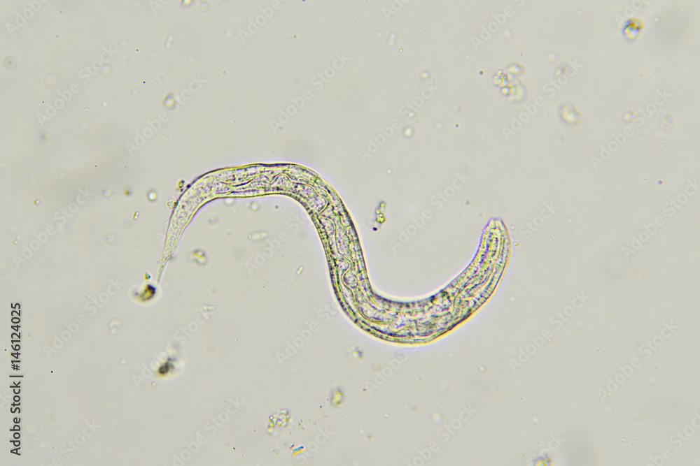 Strongyloides stercoralis (threadworm) in stool, analyze by microscope ...