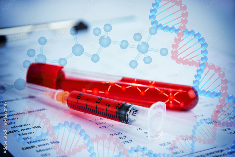 DNA testing of the blood in the laboratory with blood sample collection ...