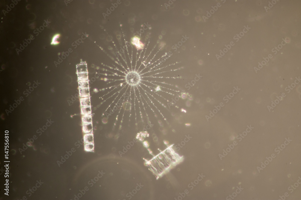 Chaetoceros (Diatom) under microscope view. Stock Photo | Adobe Stock