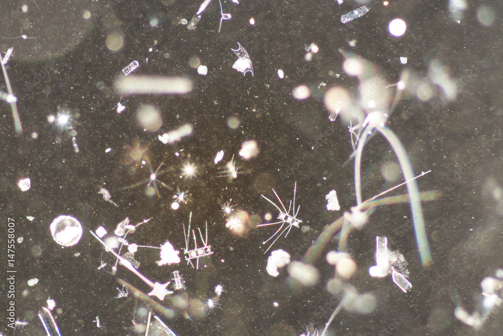 Chaetoceros (Diatom) under microscope view. Stock Photo | Adobe Stock
