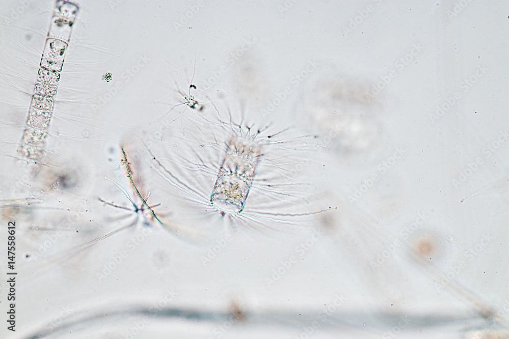 Chaetoceros (Diatom) under microscope view. Stock Photo | Adobe Stock