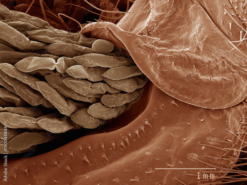 Stout spines on the gill rakers of a crayfish (Crustacea: Decapoda ...