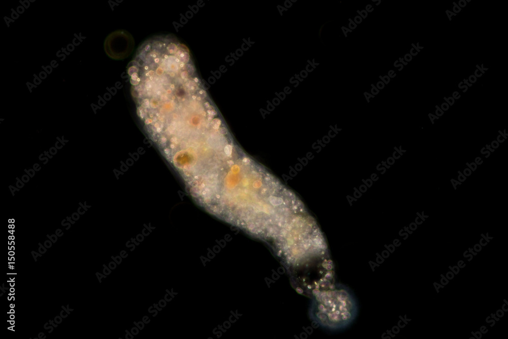 Amoebae Move And Feed By Using Pseudopods Which Are Bulges Of