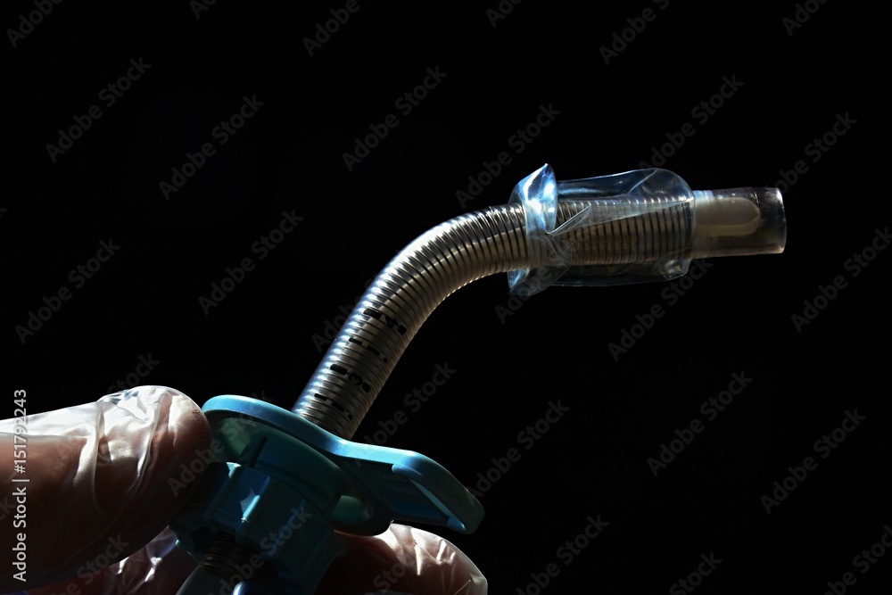 Detail of reinforced tracheostomy cannula used in emergency and icu ...