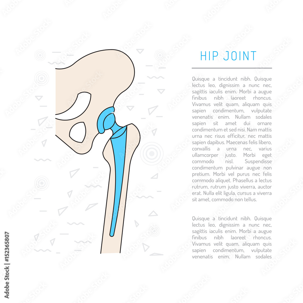 Medical illustration of the structure of the bones of the hip joint and ...