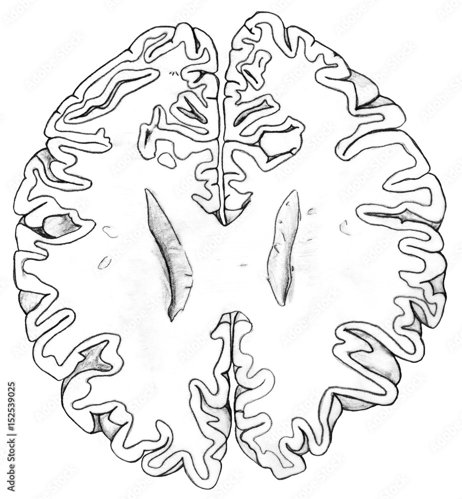 Brain section from the top of a normal human head (lower section ...