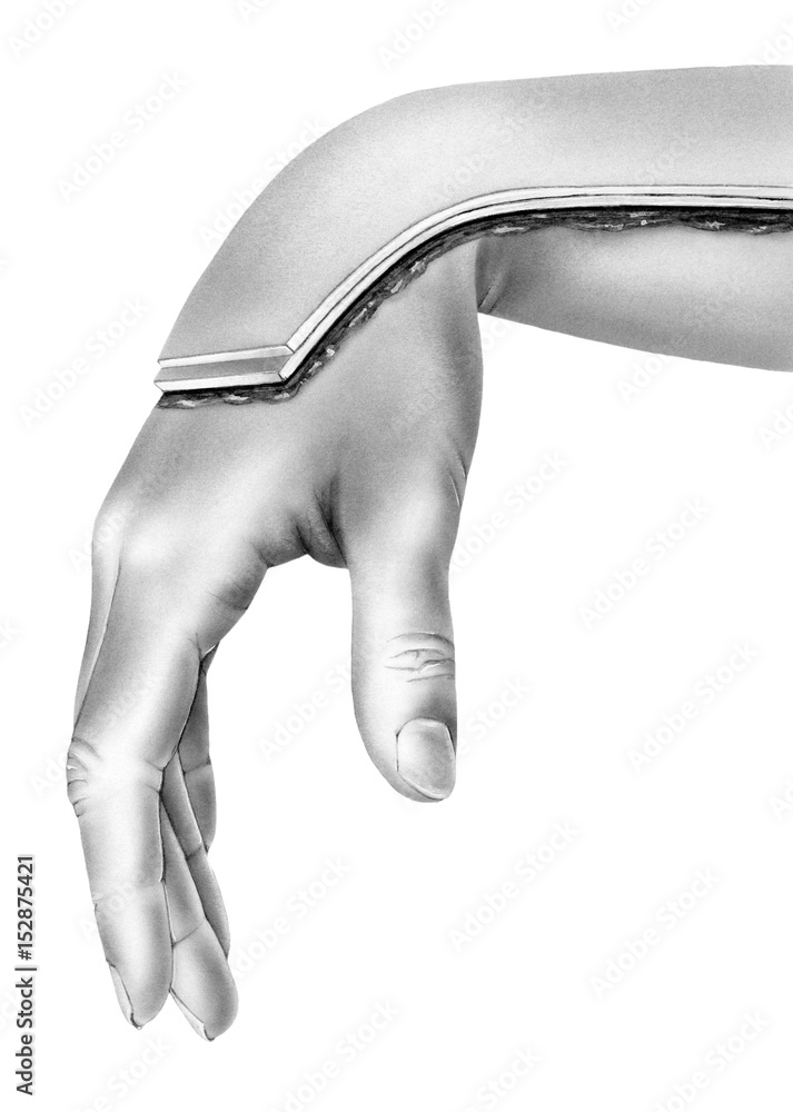 Wrist - Burn Dressing. Healing burns on the back of a human hand and ...