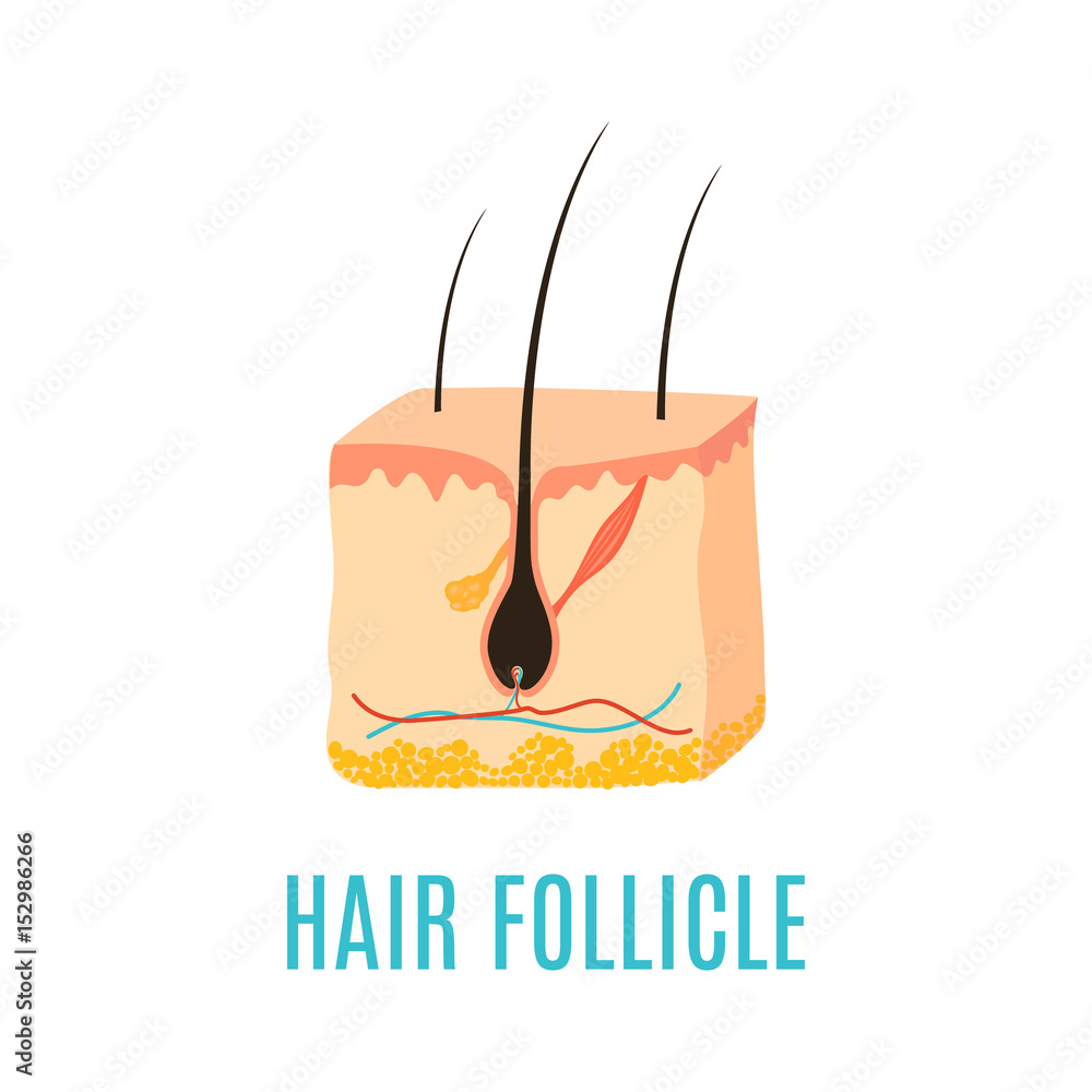 Hair follicle diagram. Hair bulb medical diagnostics symbol. Treatment ...