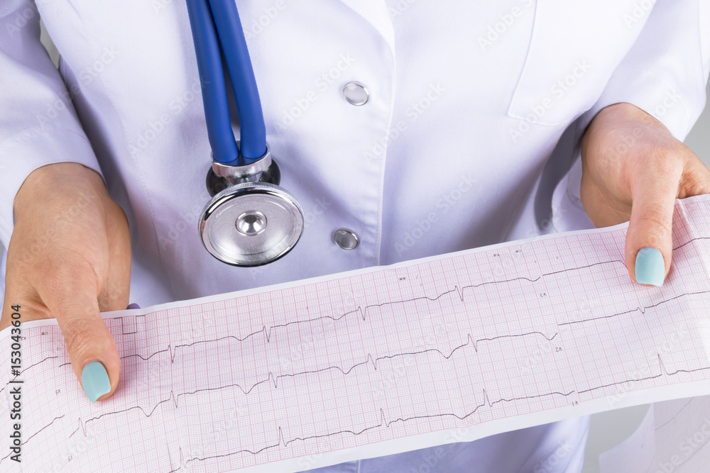 Electrocardiogram, ecg in hand of a female doctor. Medical health care ...