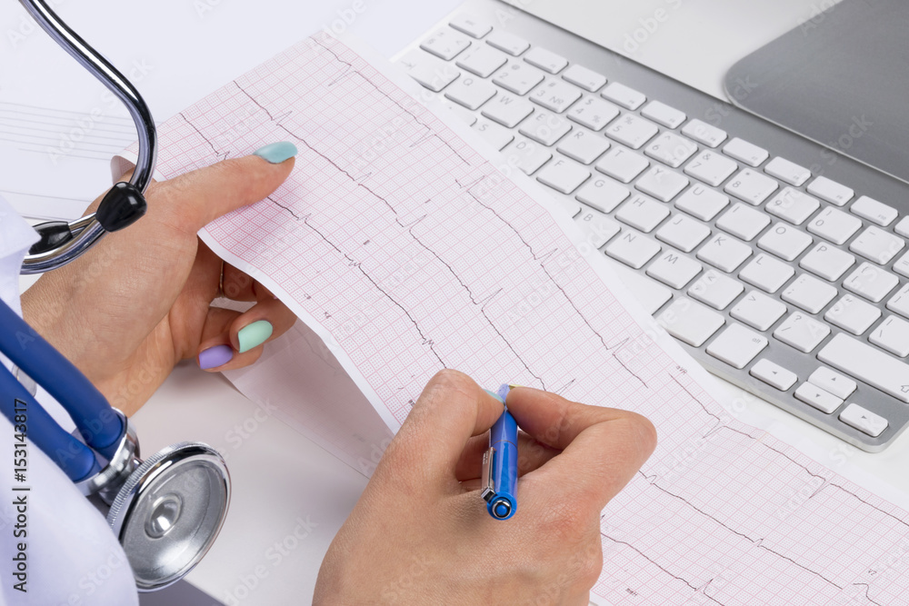 Doctor workplace. Electrocardiogram, ecg in hand of a female doctor ...