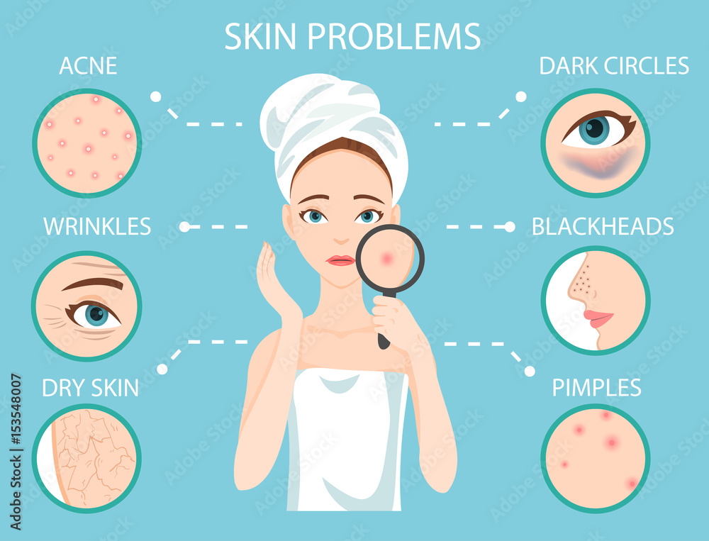 Troubled woman and set of most common female facial skin problems needs ...