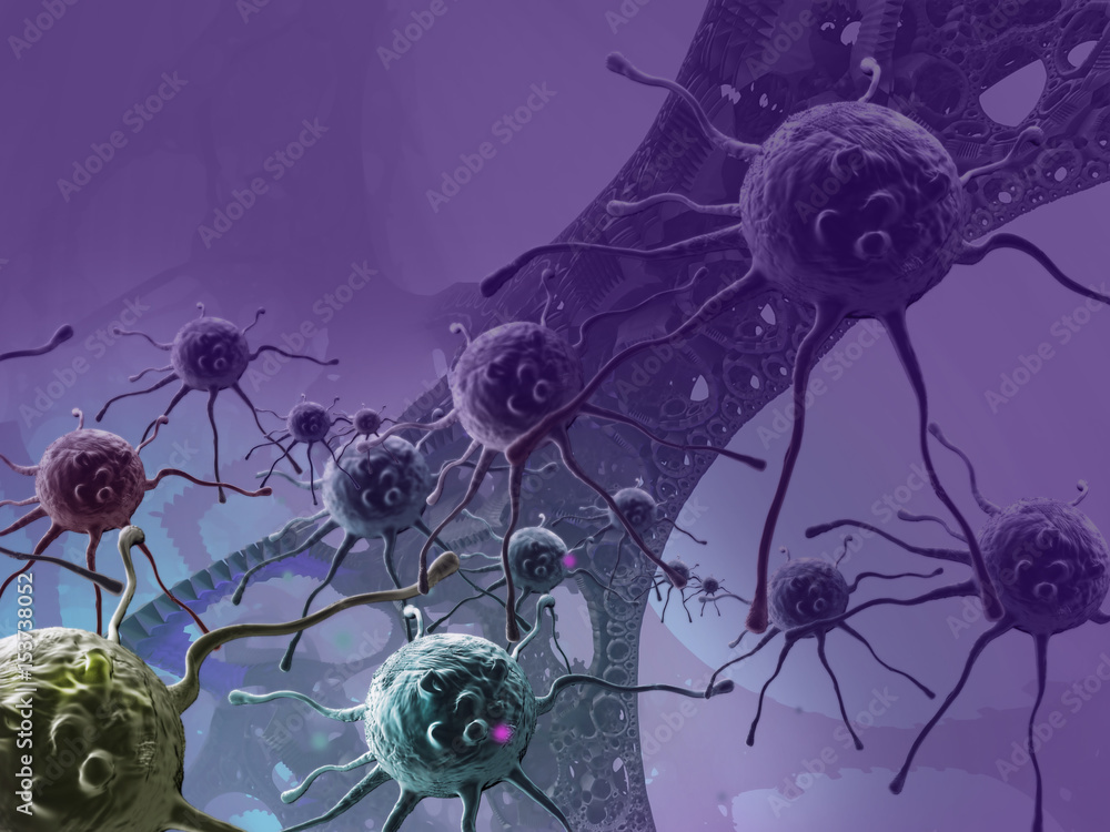 Digital 3d illustration of cancer cells in human body Stock ...