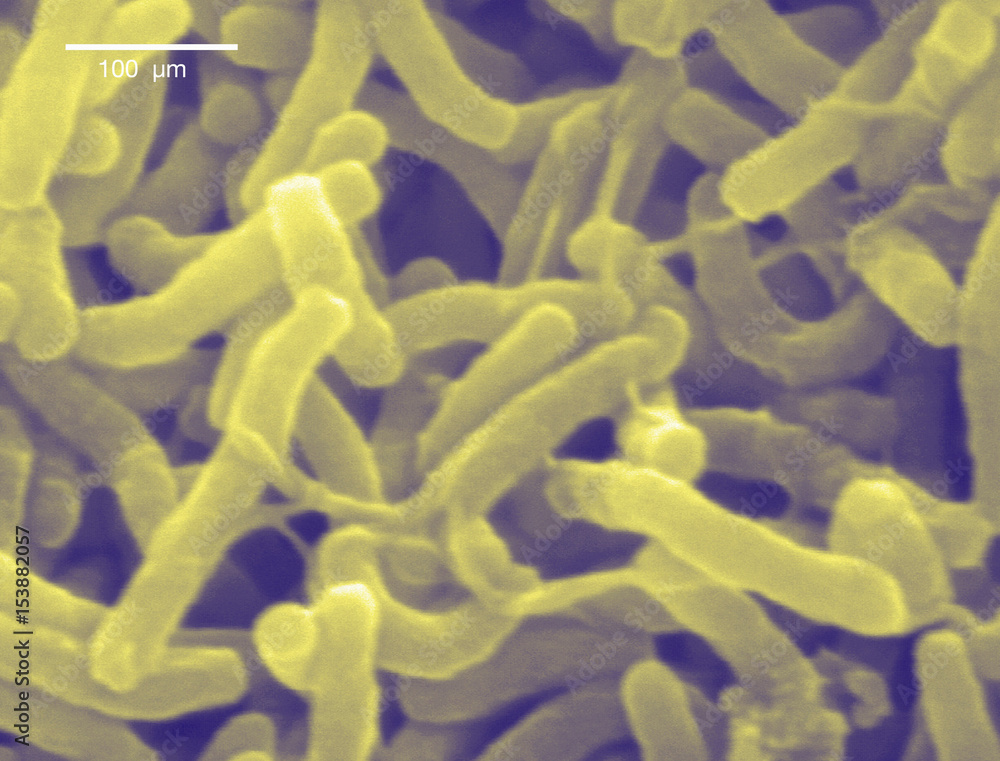 Scanning electron micrograph of Cholera bacteria Stock Photo | Adobe Stock