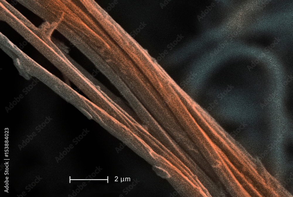 Scanning Electron micrograph of asbestos, 8000x Stock Photo | Adobe Stock