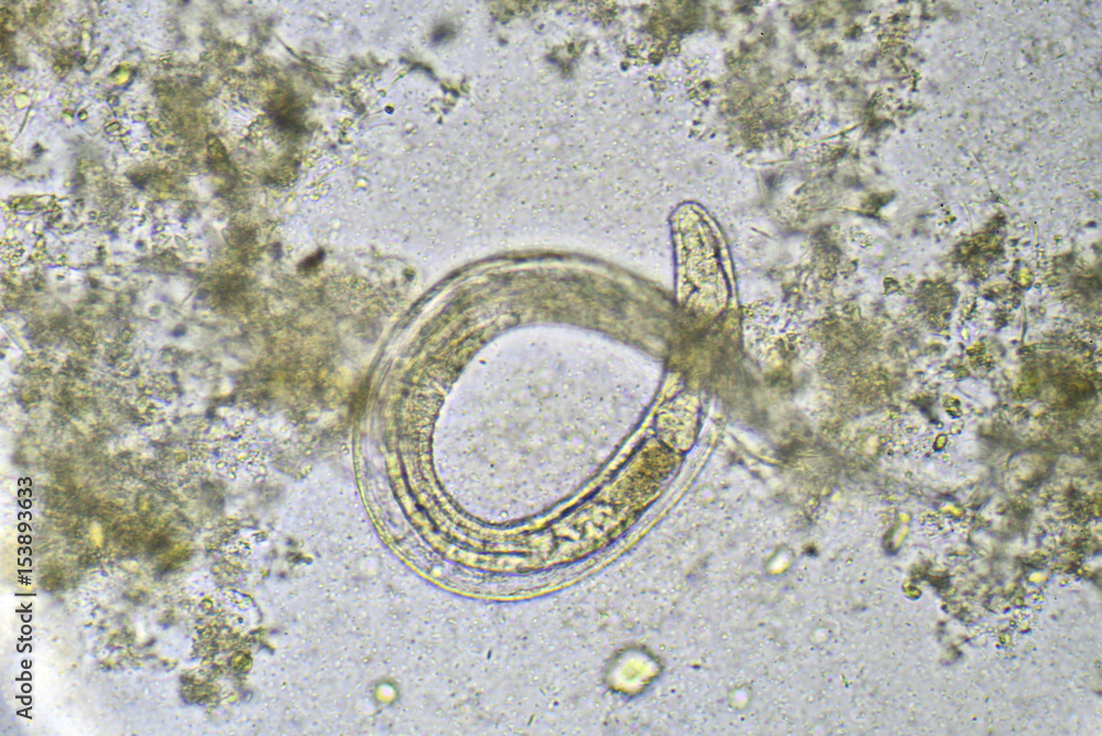 Strongyloides stercoralis (threadworm) in stool, analyze by microscope ...