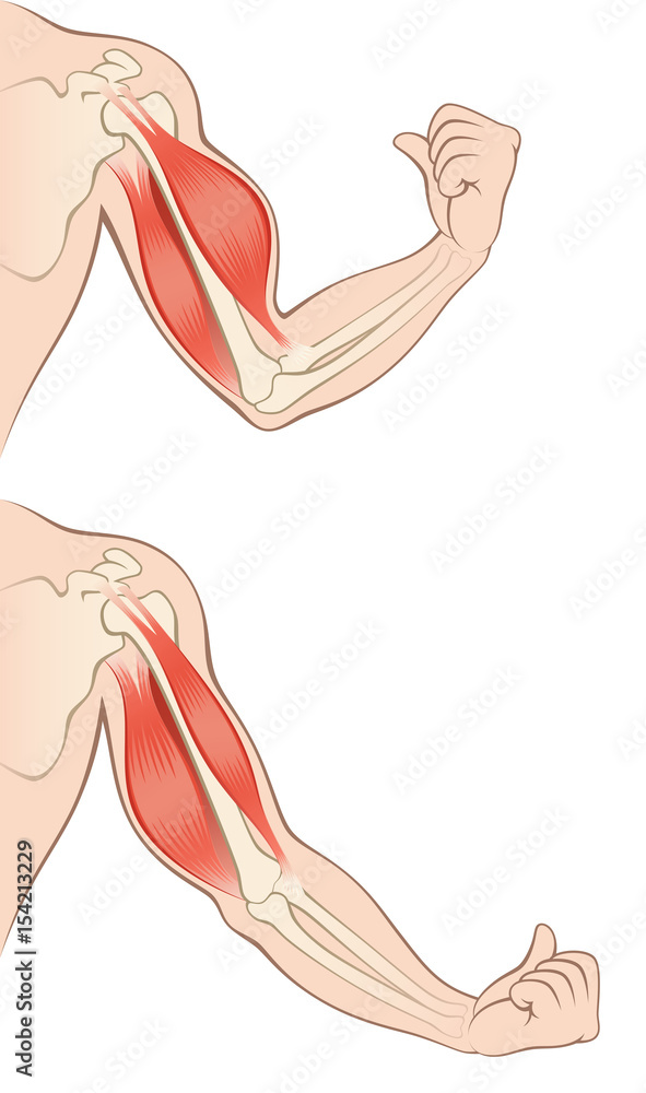 Tension muscles human hand on a white background Stock Vector | Adobe Stock