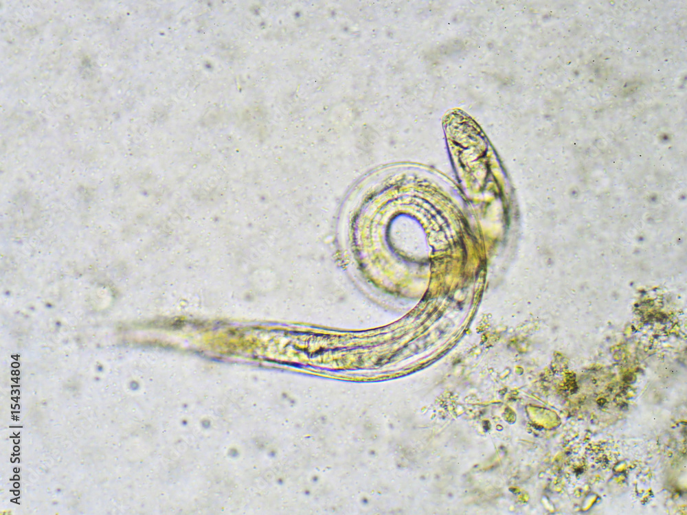 Threadworm In Stool