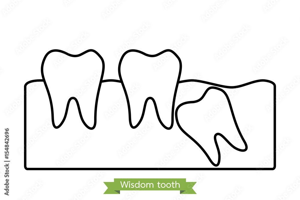 wisdom tooth - cartoon vector outline style Stock Vector | Adobe Stock