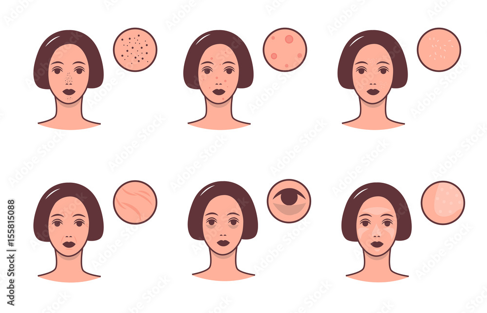 Set of female faces with various skin conditions and problem. Skincare ...