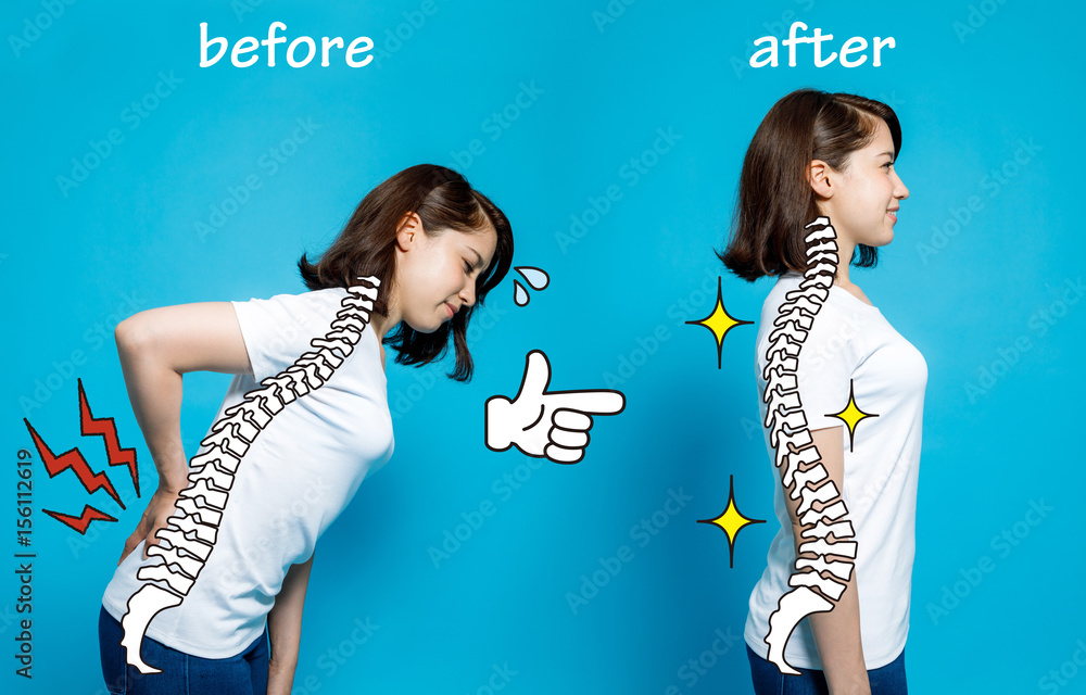 Foto de Good posture and bad posture, woman's body silhouette and ...