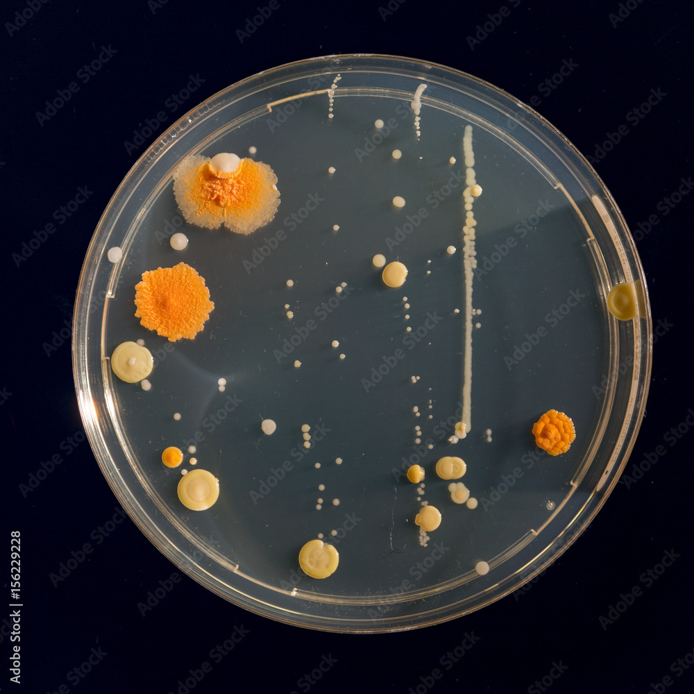 petri dish samples with bacteria and fungal colonies Stock Photo ...