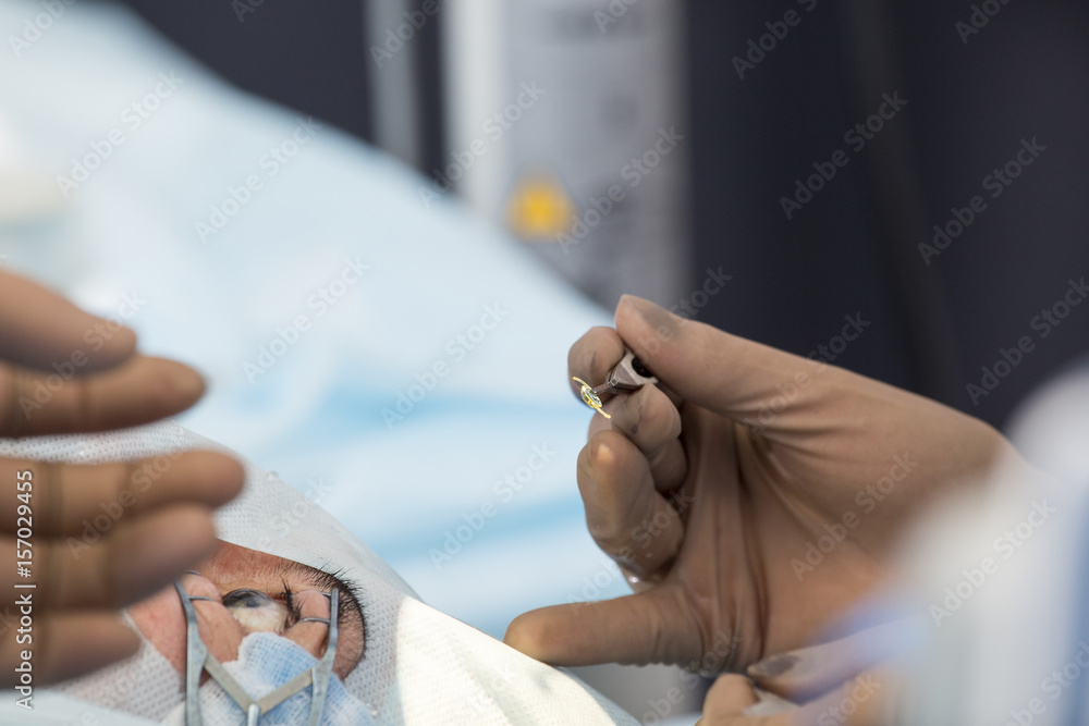 Phacoemulsification, destruction of the opaque lens of the eye by ...