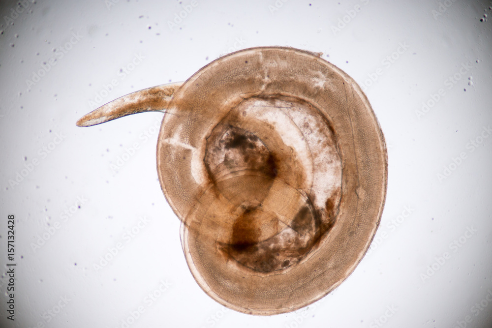 Spinitectus sp.a parasite of the fish under microscope view. Stock ...