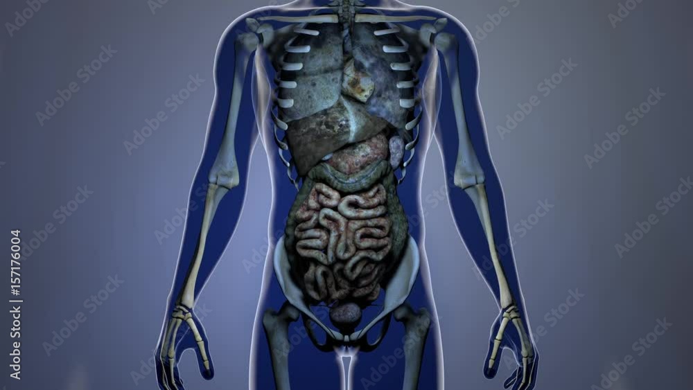 Sick Internal Organs and Skeleton in a Transparent Human Body ...