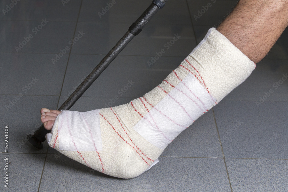 Foot soft splint for treatment of injuries from tendon inflammation ...