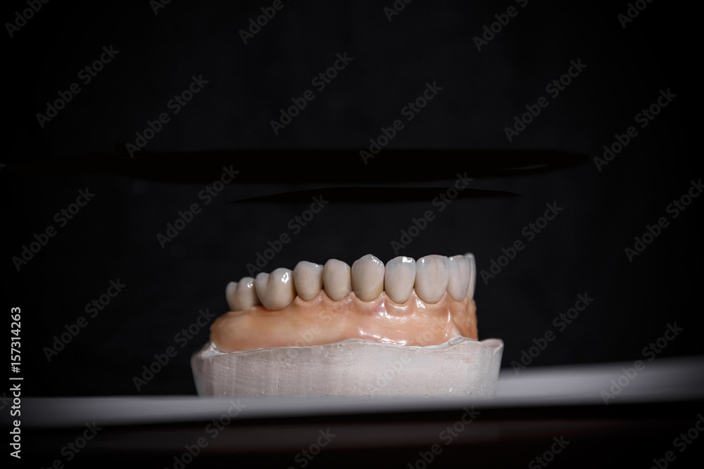 Ceramic teeth dental crowns on model, metal free - front view . Ceramic ...