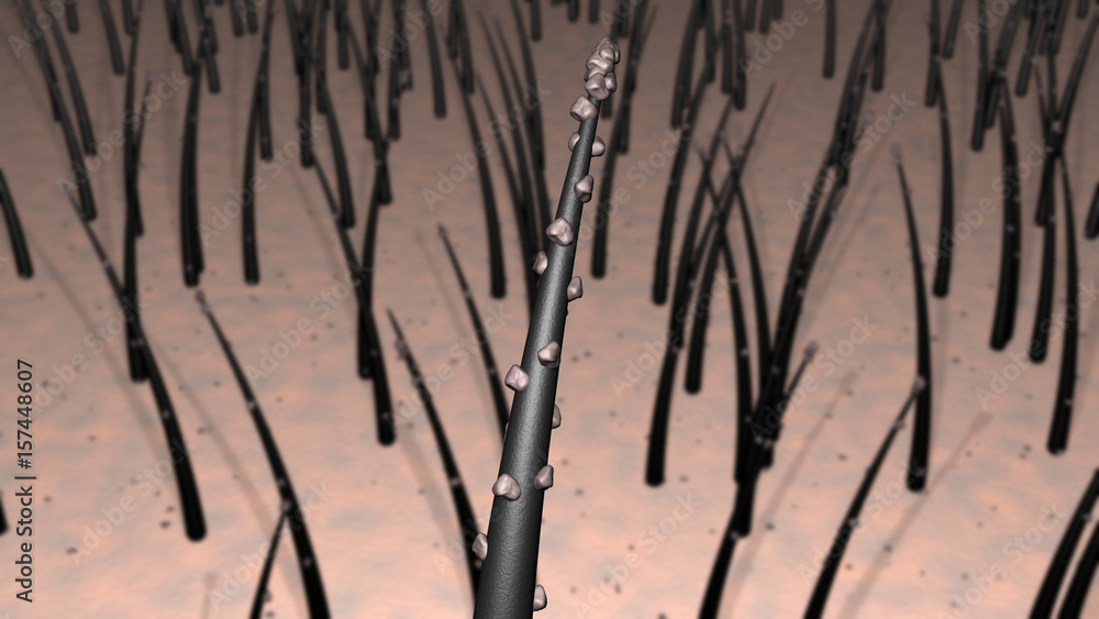 Dirt particles, dandruff, debris on both hair and scalp, skin. Depth of ...