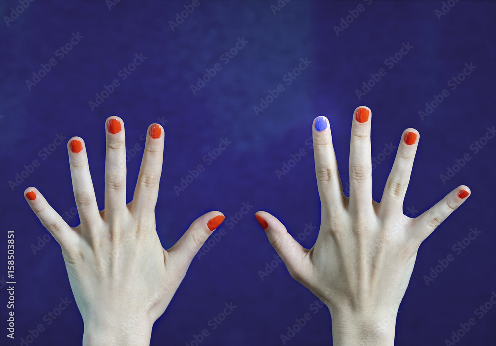 One different nail color in finger in caucasian hands. Red and blue ...