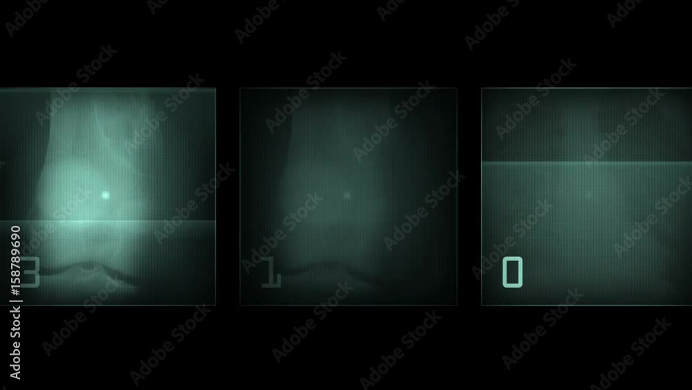 4k Human rib finger bones scan,tech medical X-ray scanning,X-ray ...