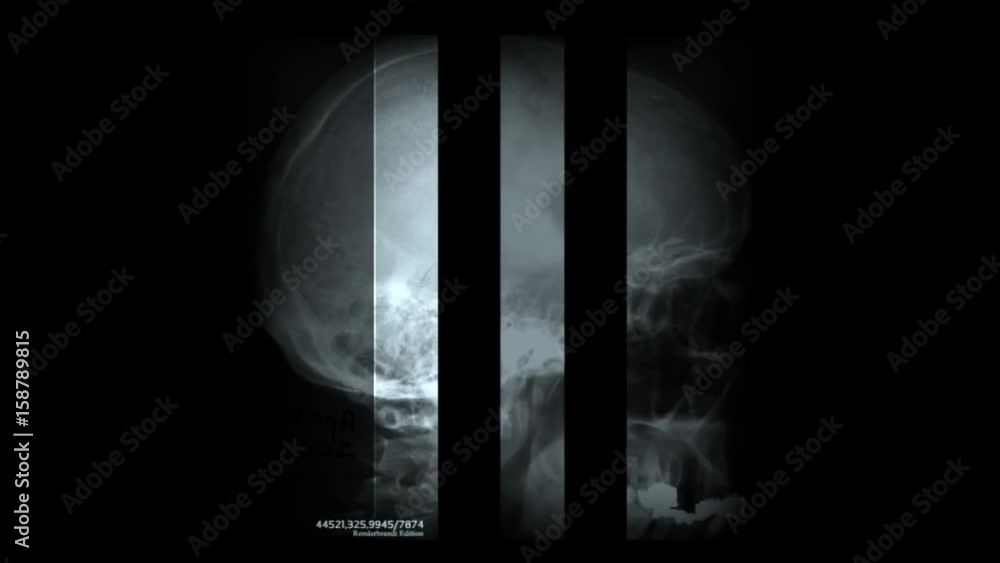 4k Human bones scan,medical scanning,abstract X-ray scientific research ...