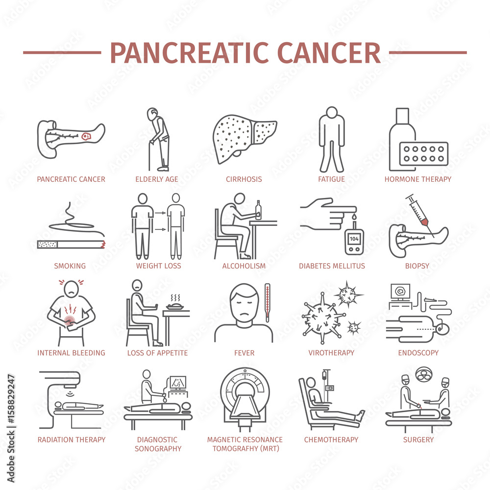 Pancreas Cancer Causes