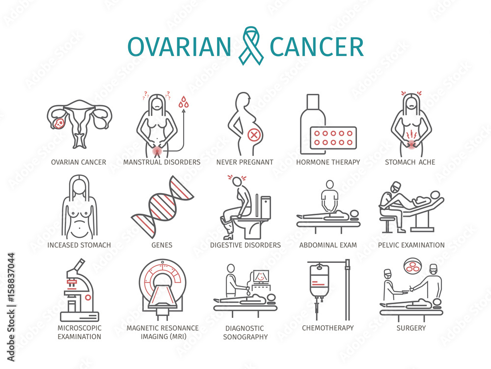 Ovarian Cancer Causes