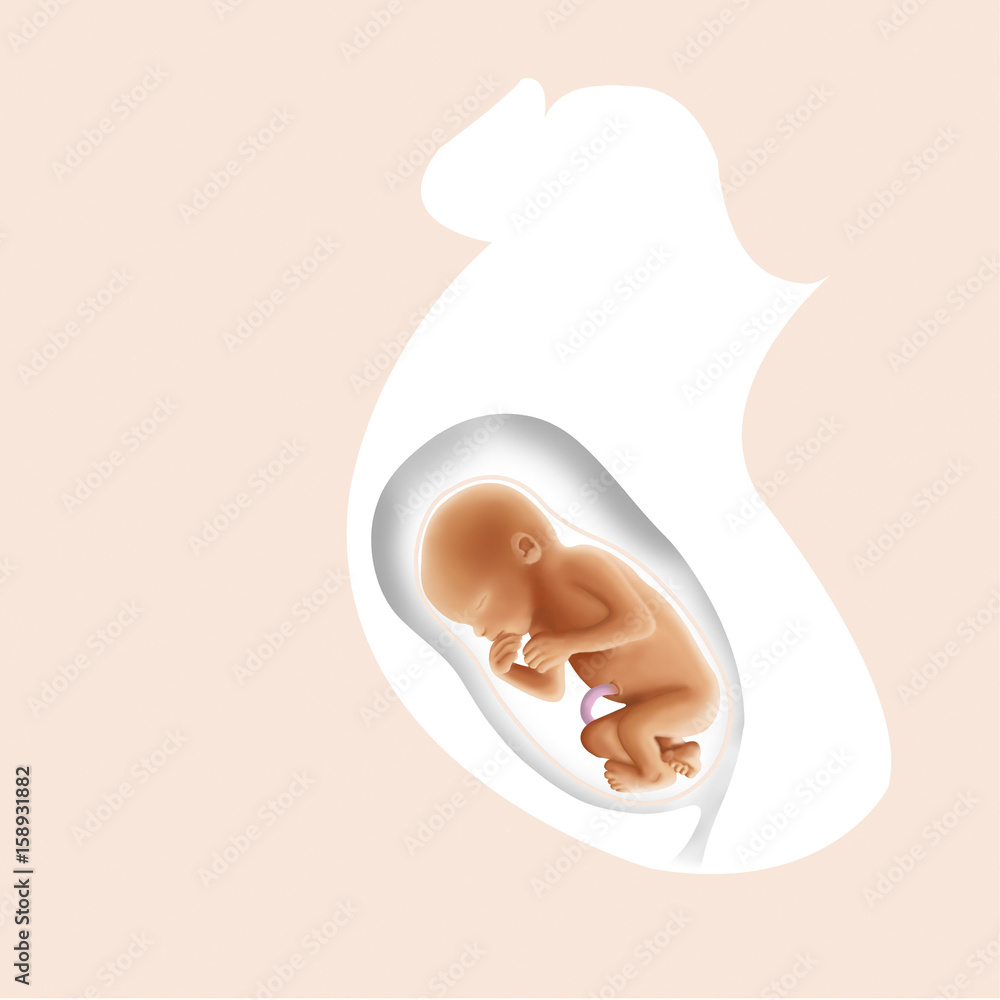 Poster Complete breech presentation of the fetus – Wall Art | UkPosters