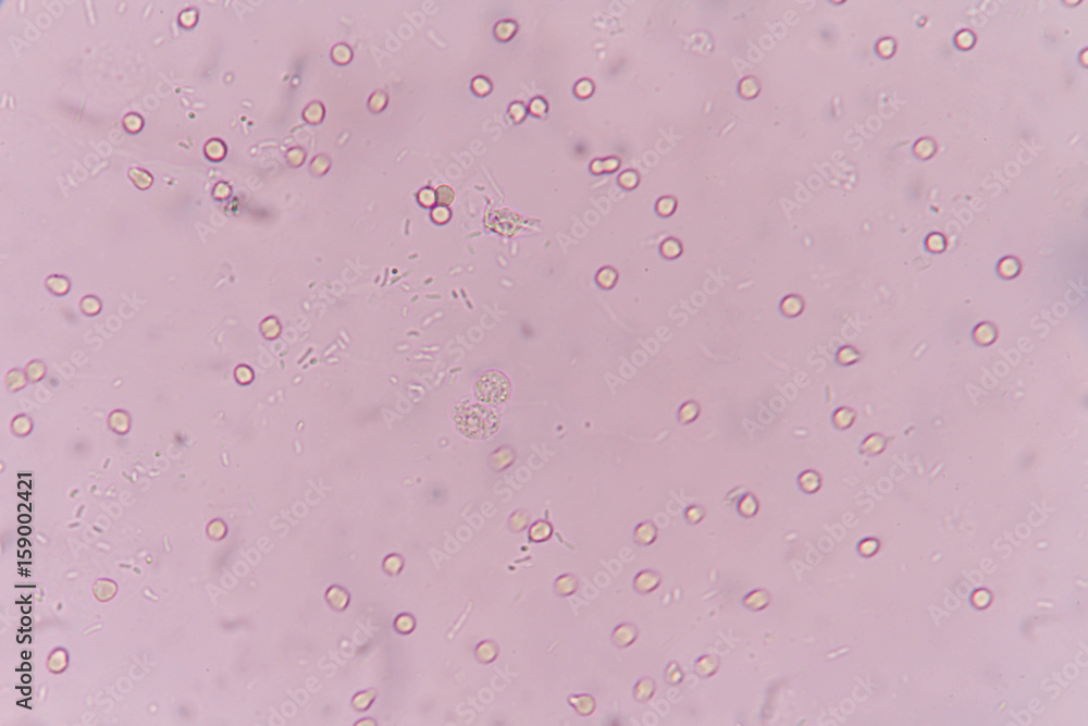 white blood cells and red blood cells in urine Stock Photo | Adobe Stock