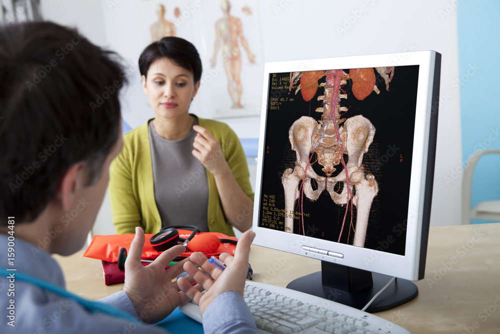 Models On screen, 3D angiography scanner Study of the blood ...