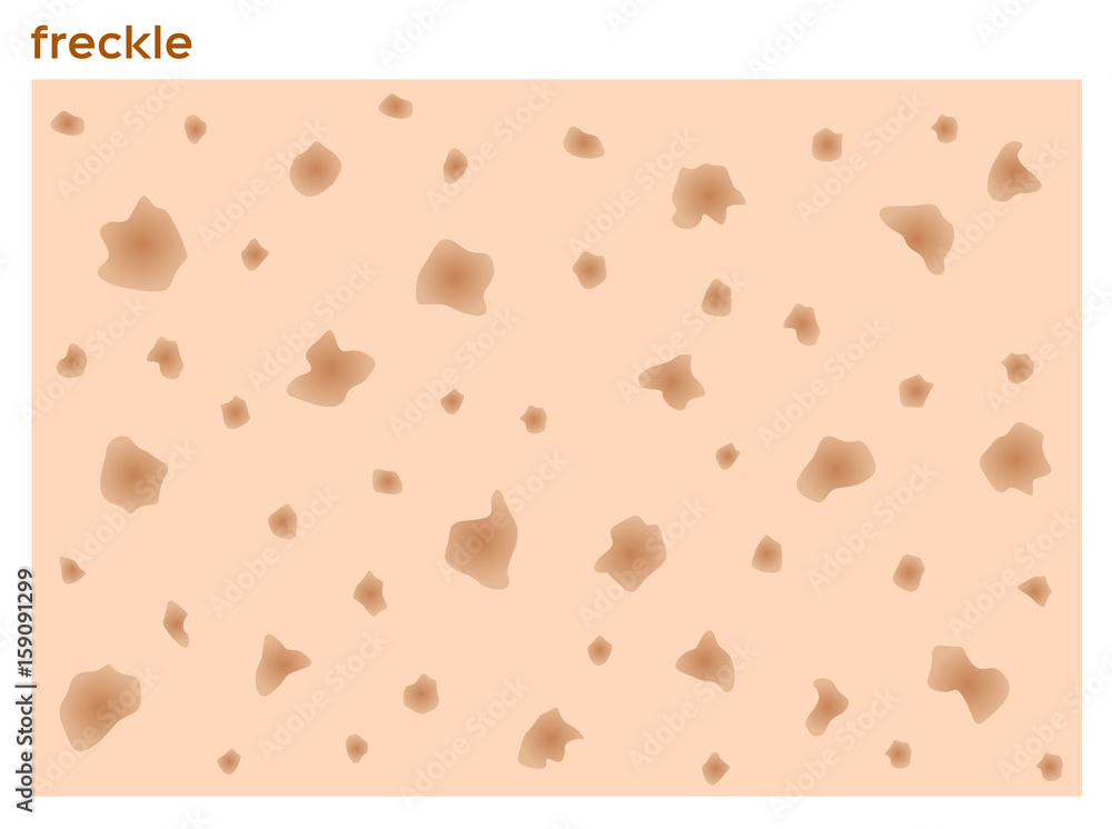 Photo & Art Print freckle skin texture graphic , vector , nice skin ...