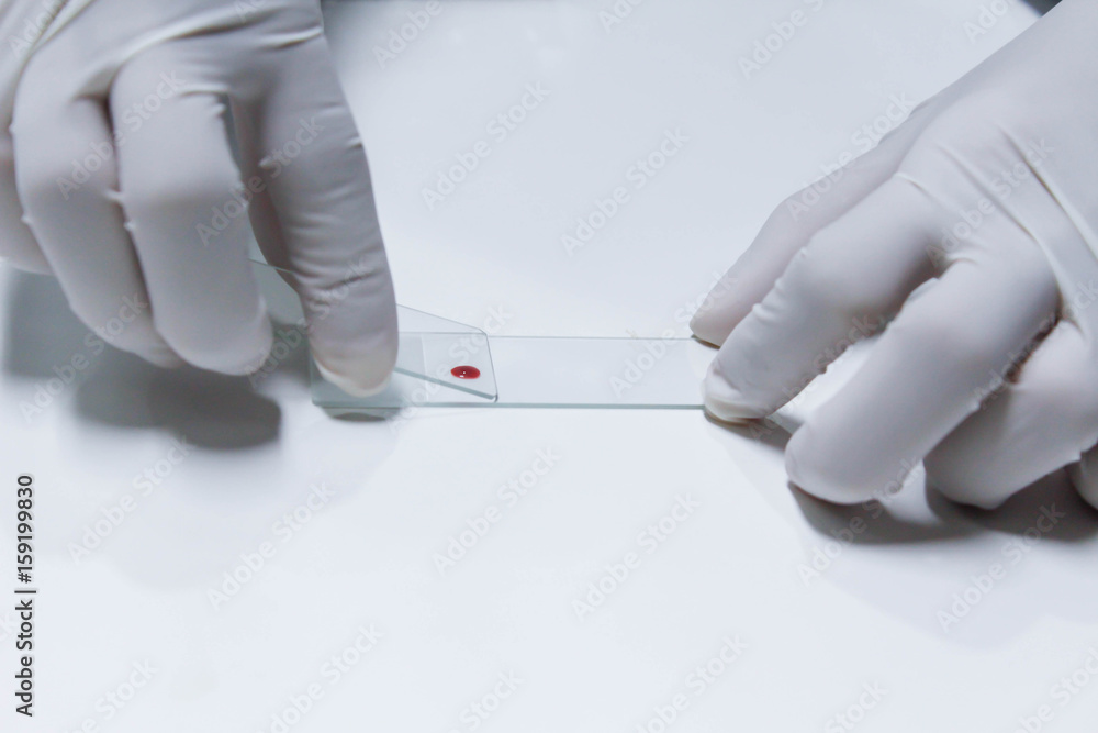 sample for blood smear method Stock Photo | Adobe Stock