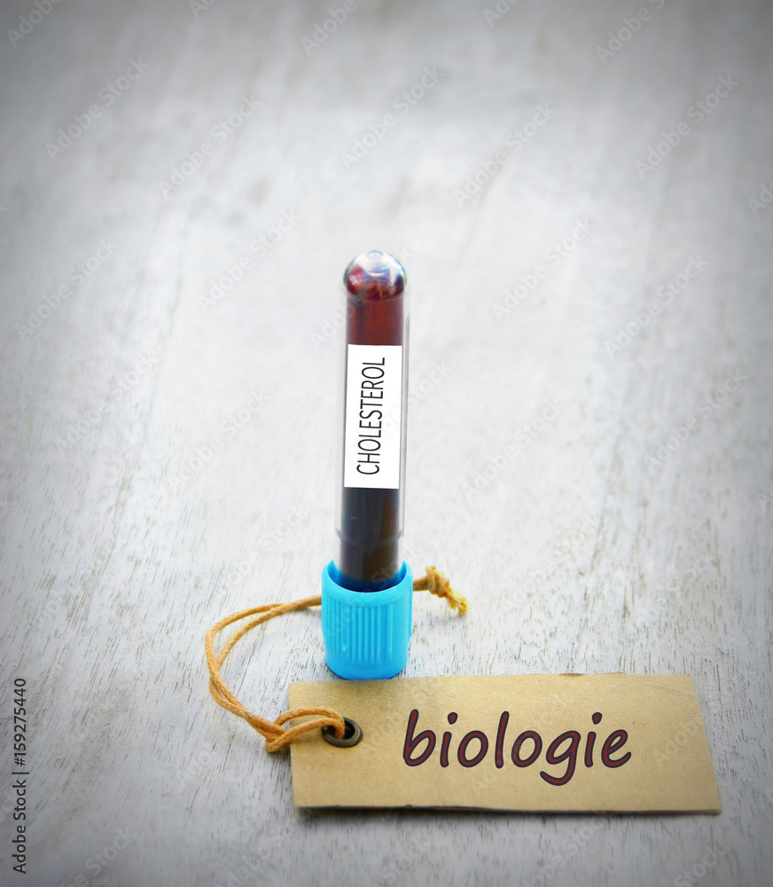 analyse de cholestérol,tube de prélèvement de biologie Stock Photo ...